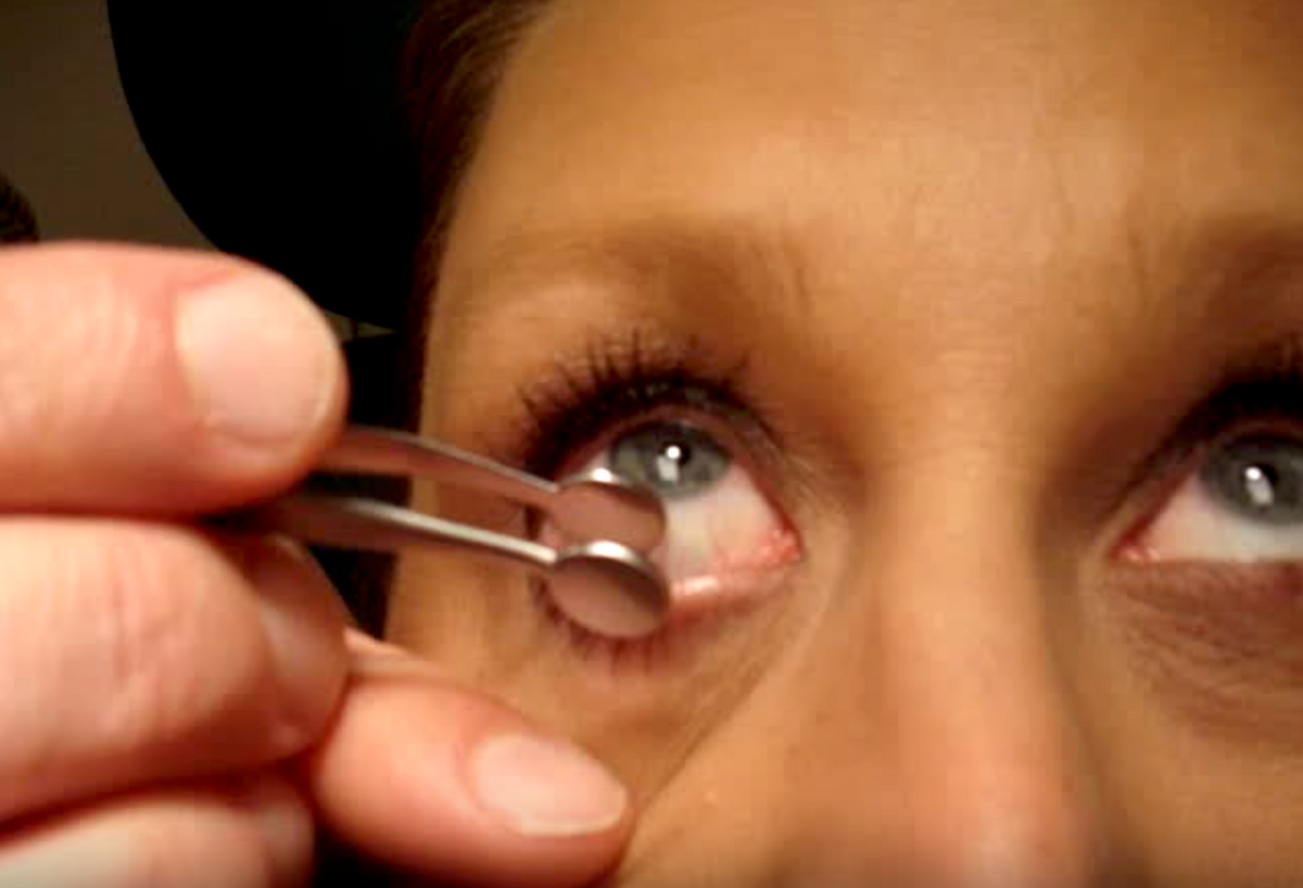 Collins Expressor Forceps – Bruder Healthcare Company